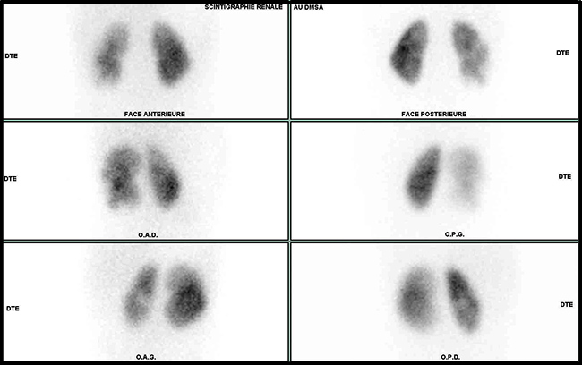 Qu'est ce qu'une scintigraphie? - Normandim